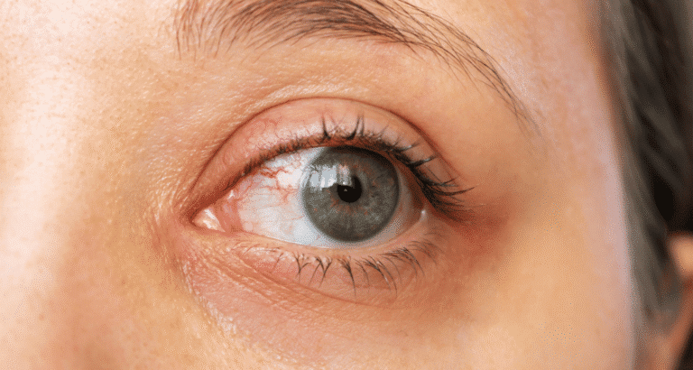 Pros and Cons of Eye Dilation: What You Need to Know - Barnes Talero ...